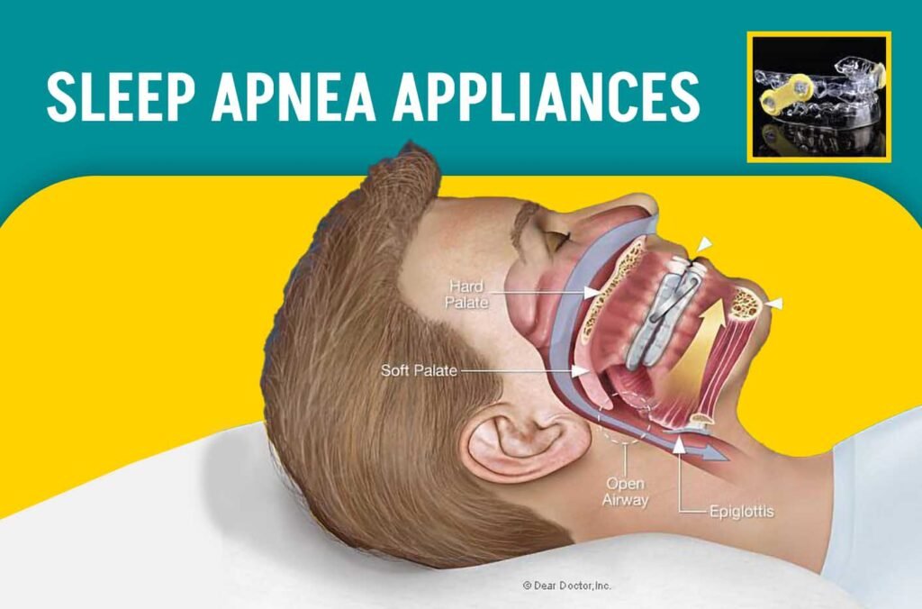 Sleep Apnea Appliances In 2024 Transforming Your Sleep With Top 4 Products